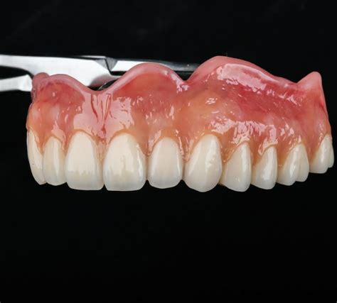 دندانسازی ساخت دندان مصنوعی با شرایط اقساطی در بندرعباس