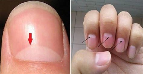 Look At Your Fingernails Did You Notice A White Half Moon Shape That