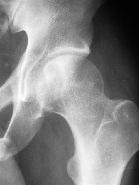 Ucsd Musculoskeletal Radiology