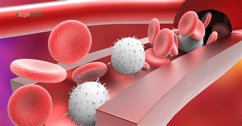 Стеноза Митрална и Аортна