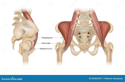 Internal Snapping Hip Syndrome Psoas Major Iliopsoas Muscle And