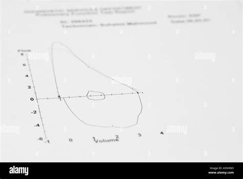 Spirometry Graph From A Lung Pulmonary Function Test Pft Used To