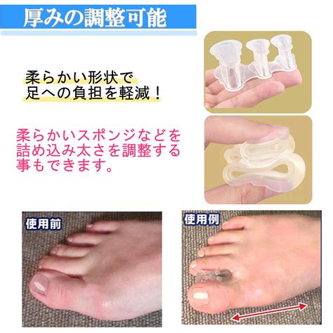 【楽天市場】外反母趾 内反小趾サポーター 足指セパレーター 柔らかシリコン 指間 クッション 内反 外反 親指 中指 人差し指 薬指 小指