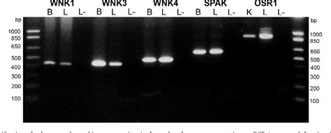 Figure 1 From Identification Of The Wnk Spakosr1 Signaling Pathway In