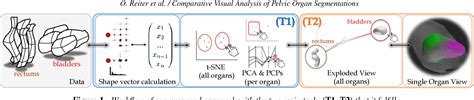 Figure 1 From Comparative Visual Analysis Of Pelvic Organ Segmentations Semantic Scholar