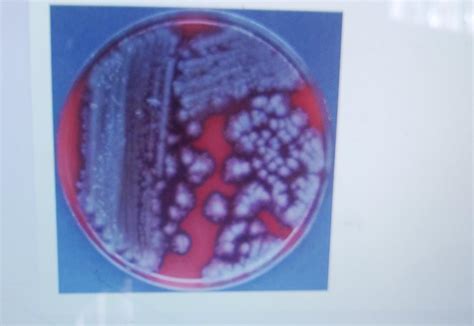 Solved Which Organism Would Exhibit Alpha Hemolysis