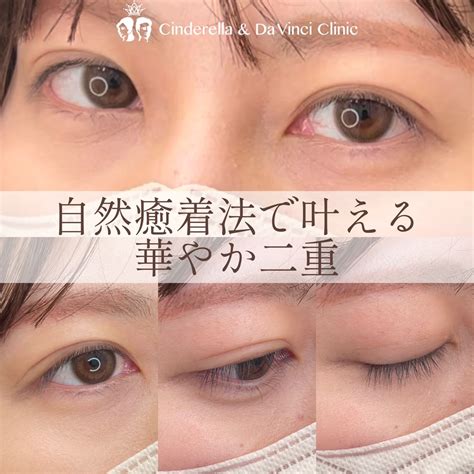 症例一覧 名古屋の美容外科｜cinderella And Da Vinci Clinic【公式】