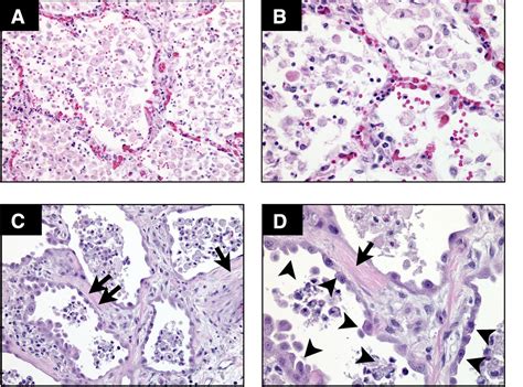 Figure 1 From Animal Models Of Acute Lung Injury Semantic Scholar