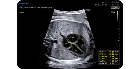 Hera W10 Elite Samsung Business Polska