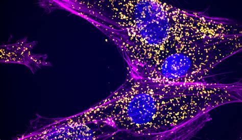 Research Links Integrator Mutations To Neurodegeneration Cancer Mirage News