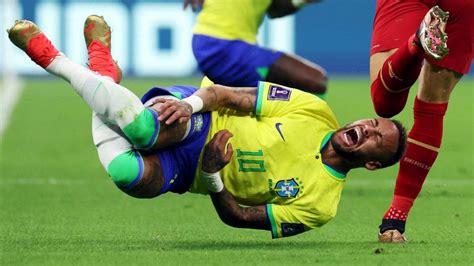 Impactante Así quedó la pierna de Neymar tras la victoria de Brasil