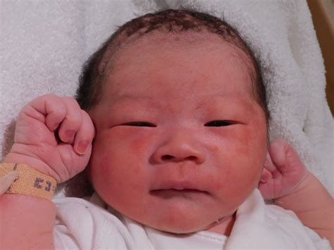 令和6年8月13日 日本海病院産婦人科
