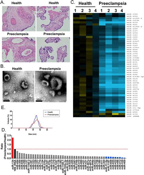 Differential Expression Of The Dlk1 Dio3 Imprinted Mir Cluster In