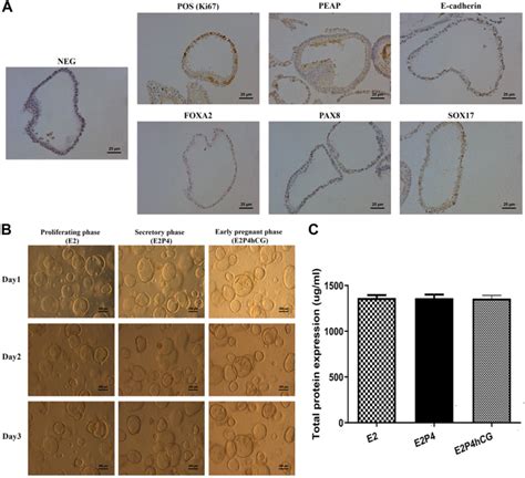Integrated Microrna And Secretome Analysis Of Human Endometrial