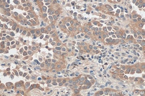 Slc7a5 Polyclonal Antibody 28670 1 Ap150ul