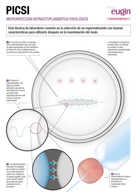 Infograf A Esp Picsi Xaviisern Estudi