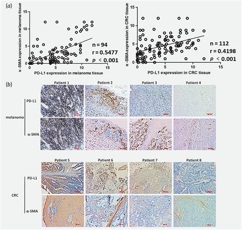Cancer‐associated Fibroblasts Promote Pd‐l1 Expression In Mice Cancer