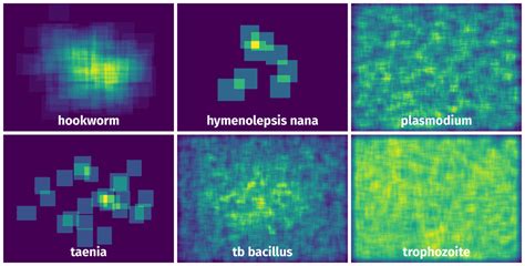 Microscopy Malaria Dataset Dataset Ninja