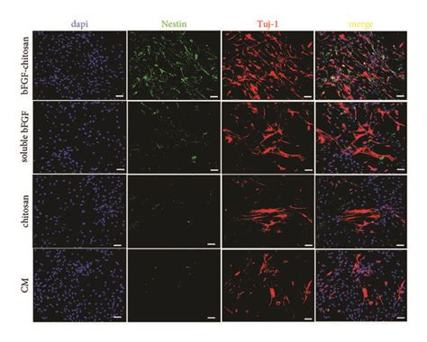 Under Different Coculture Conditions Bmscs Were Induced To