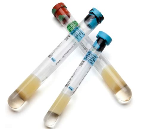 BD Vacutainer CPT Mononuclear Cell Preparation Tube Sodium Citrate