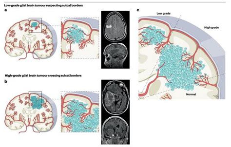 Nat Rev Neurosci重要综述：脑血管系统研究进入单细胞时代 知乎