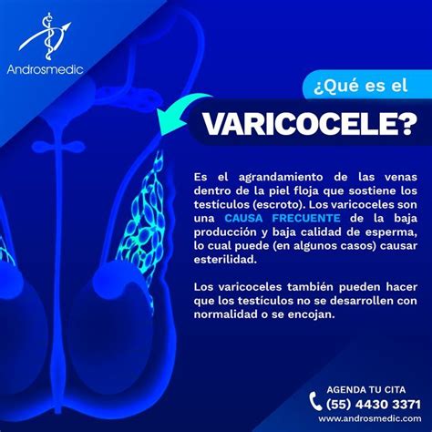 ¿qué Es El Varicocele