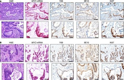 Image Cropping On White Boundaries From A Complex Image Using Python