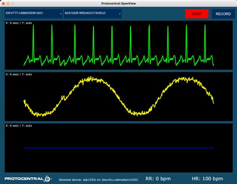 Ads R Ecg Respiration Breakout Kit Docs Protocentral