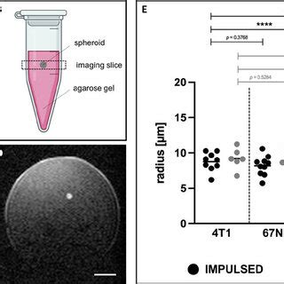 OGSE DWI Is Able To Differentiate Between Cancer Cells Macrophages