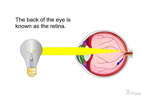 Diabetes Eye Complications