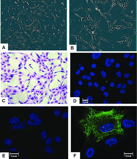 Primary Murine Tsmcs Cultured In Dmem Complete Medium In The Process