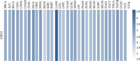 Usp15s High Expression Of Breast Cancer Has A Poor Prognosis A