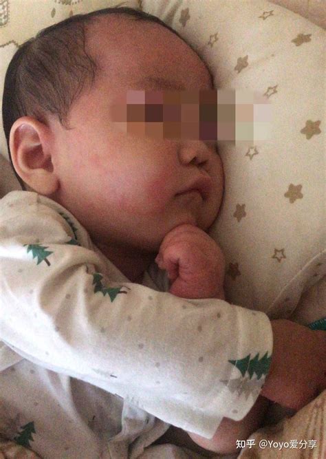 家有湿疹宝宝用什么身体乳好？ 知乎