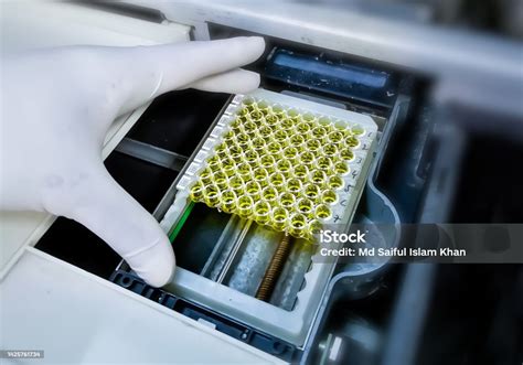 의료 실험실에서 효소 연결 면역 조벤트 분석법 플레이트 면역학 또는 세로지 테스트 방법 분석법에 대한 스톡 사진 및 기타 이미지