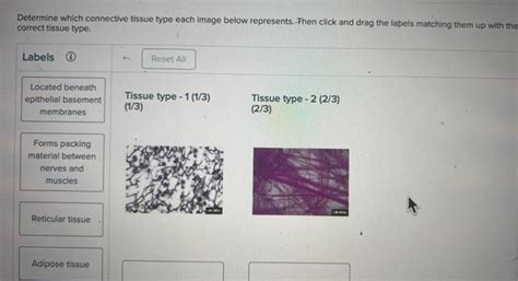 Solved Determine Which Connective Tissue Type Each Image Chegg
