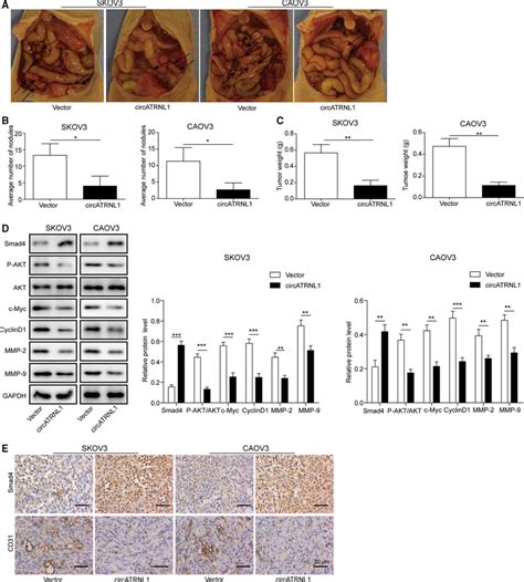 Overexpression Of Circatrnl1 Inhibited Ovarian Cancer Abdominal