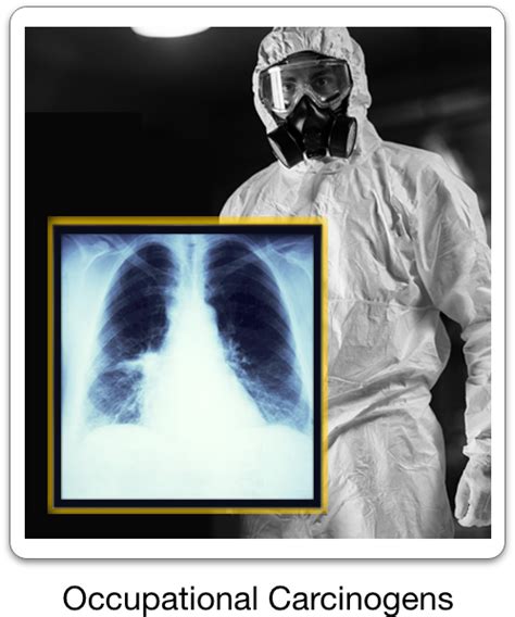 Carcinogens
