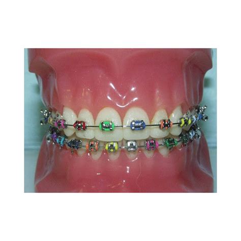 27 Best Customized Braces Images On Pinterest Braces Orthodontics And Teeth