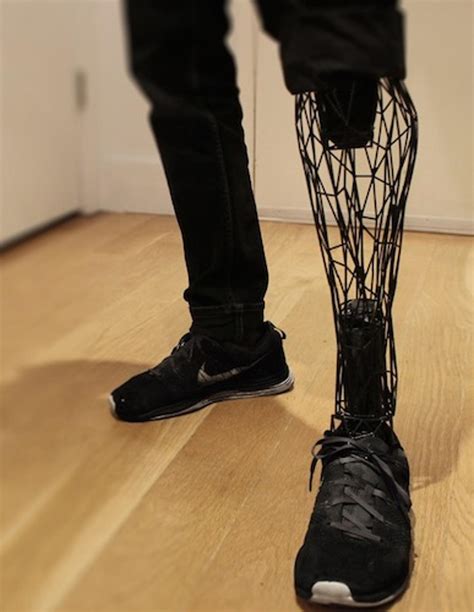 3d Printed Exo Prosthetic Leg Designed To Be Affordable And Beautiful