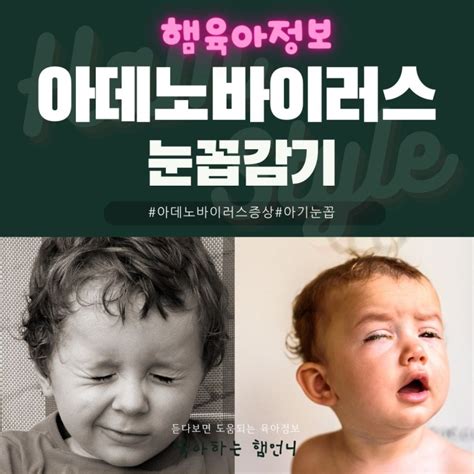 아데노바이러스 감염 증상 전염 아기 눈꼽 감기 바이러스 안약 치료 네이버 블로그
