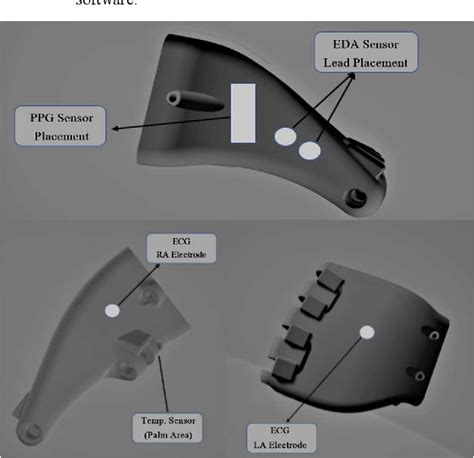 Figure 4 From Design Of A Robotic Arm For Human Contactless Patient Monitoring Through Measuring