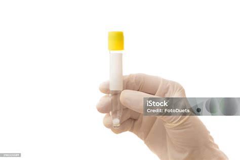 흰색 고무 보호 장갑을 낀 의사는 소변 또는 흰색 배경에 격리 된 기타 분석 테스트를위한 빈 투명 플라스틱 튜브를 들고 있습니다 근접 촬영 앞 모습 손에 대한 스톡 사진 및