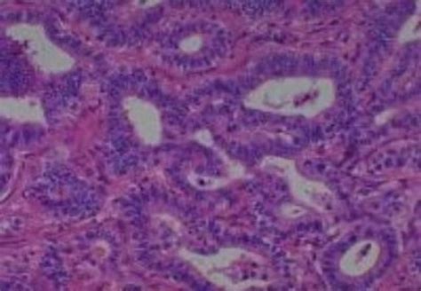 Novus Biologicals Human Various Tissue Microarray Slide Human Ovary