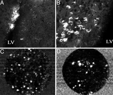 Transfection Of Ormosil Pegfp N2 Complex Into The Lv Cells Of The Svz