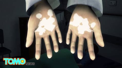 환자의 얼굴에 사정한 의사 법정에서 어이없는 변명 늘어놓아 Youtube