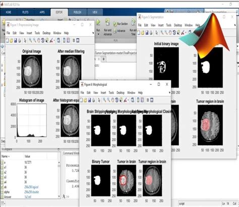 خرید و قیمت شبیه سازی تشخیص تومور مغزی با استفاده از شبکه عصبی کانولوشون در متلب پردازش تصویر