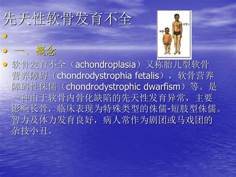 先天性软骨发育不良