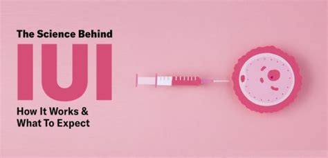 What Is IUI How It S Work And What To Expert Dr Divya Kumar