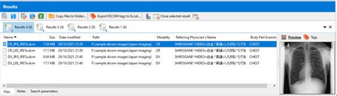 easy dicom search released yohz software development blog