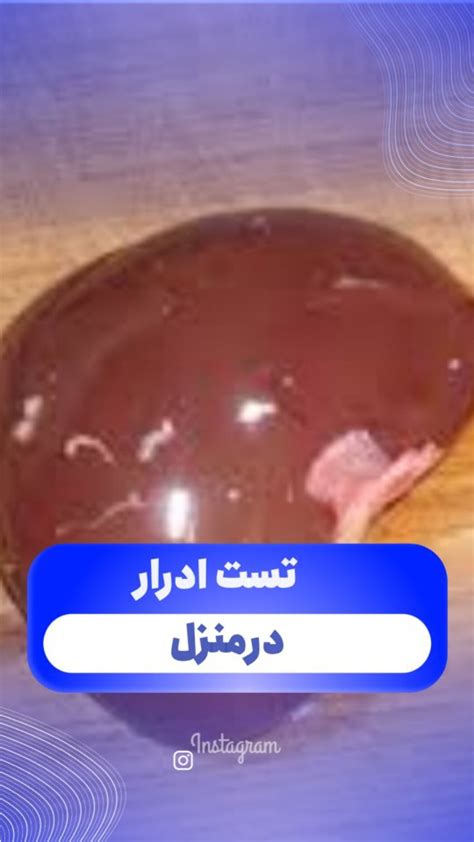 ‎سردی بلغم گوارشی جنسی‎ ‎ادرار سالم باید چی رنگی باشه 🥺🥺 اول